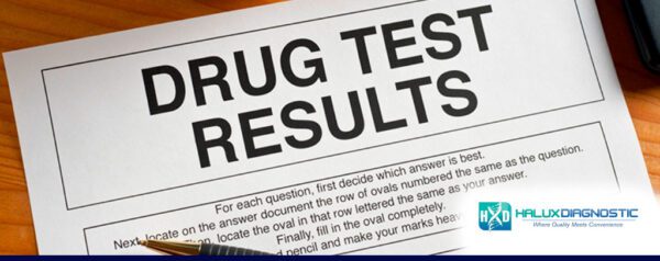How much should a drug test cost? - Halux Diagnostic