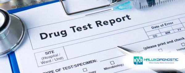 The most common way to test for drug - Halux Diagnostic