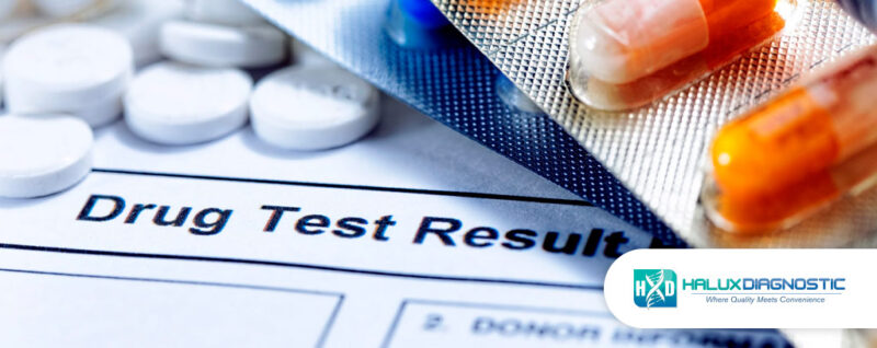 Which Type of Drug Test Should I Use? - Halux Diagnostic