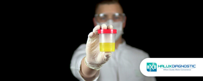Workplace Drug-testing Programs - Halux Diagnostic