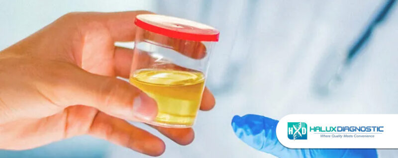 How Many ML of Urine do You Need For a Urine Drug Test?
