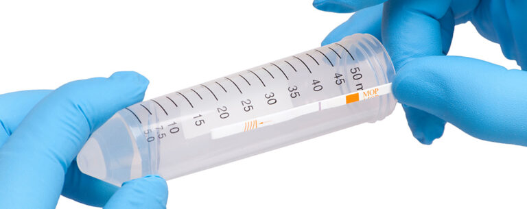 ETG Urine Alcohol Tests: 20 Things to Know