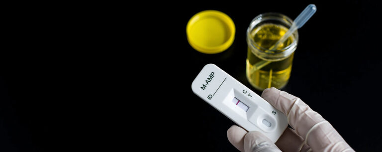 How to Read a Drug Test Cup: A Comprehensive Guide